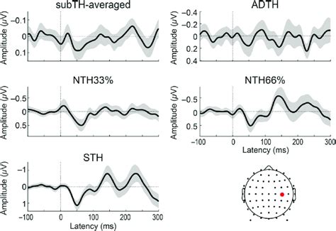 Grand Average Sep Waveforms For All Stimulation Conditions At Download Scientific Diagram