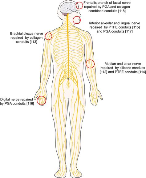 Schematic Illustration Of Clinical Trials Of Peripheral Nerve Repair