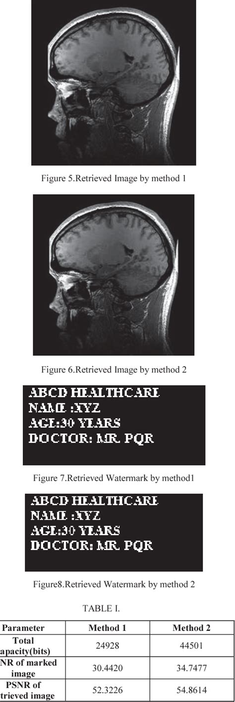 Figure 1 From Comparison Of Reversible Watermarking Usingprediction