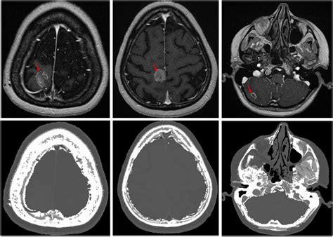 Magnetic Resonance Slices Upper Row And Corresponding Synthetic‐ct Download Scientific