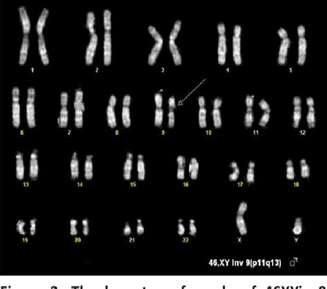 Figure From Management Challenges Of Disorders Of Sex Development Case Series Semantic Scholar