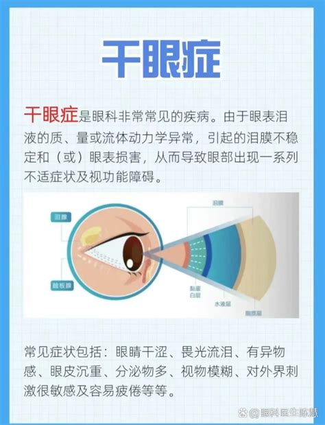 干眼症是什么原因引起的？