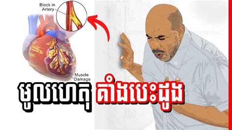 ជំងឺ គាំង បេះដូងៈ មូលហេតុ រោគសញ្ញា ការព្យាបាល វិធីបង្ការ Heart Attack Youtube