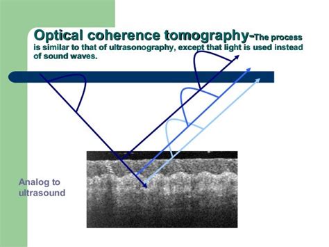 Optical Coherence Tomography Information Phase Nerygems