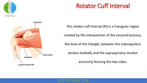 Rotator Cuff Interval Orthofixar Orthopedic Surgery Facebook