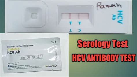 Hepatitis Serology Test At Daniel Gilmore Blog