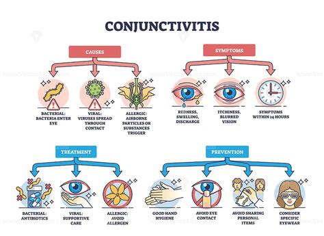 Conjunctivitis Or Pink Eye Causes Symptoms And Treatment Outline Diagram Vectormine