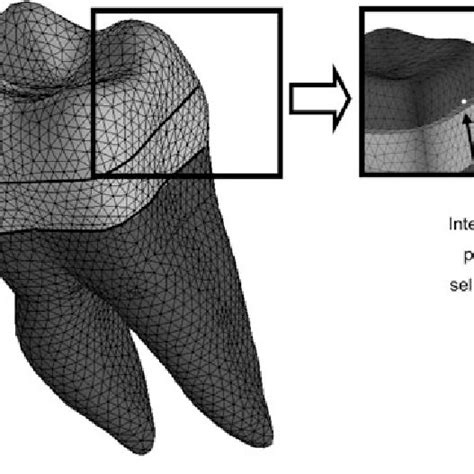 Finite Element Model Of The Tooth With Internal Interface Point
