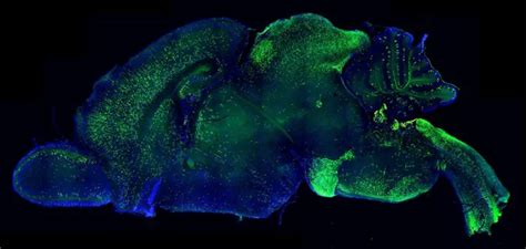 CRISPR Screen Broadens And Quickens Study Of Gene Function Across Cell Types