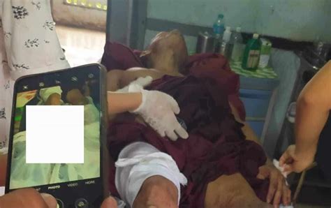 ကျုံဒိုးရှိ ဘုန်းတော်ကြီးကျောင်းဝင်းအတွင်း သံဃာတစ်ပါး မိုင်းနင်းမိ၍ ခ