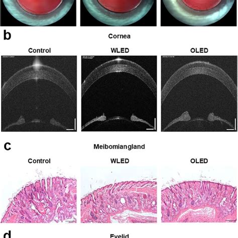 Morphologic And Histologic Findings Of The Anterior Segment After Light