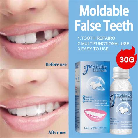 Temporary Tooth Repair Kit Dental Filling Teeth Gaps Moldable