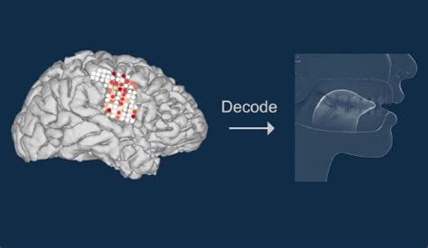 How To Decode Brain Signals Into Speech My Digital