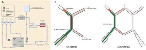 A Benchtop Pulsatile Flow And Cerebrovascular Network Model System By