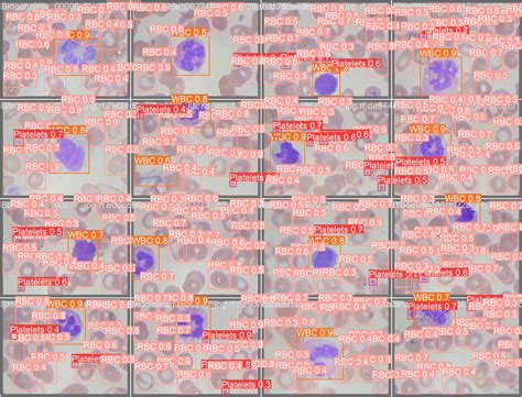 【深度学习目标检测】十四、基于深度学习的血细胞计数系统 含gui（bcd数据集，yolov8）血细胞数据集 Csdn博客