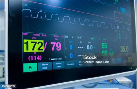 활력 징후를 표시하는 병원 모니터 심박수 혈압 체온 및 맥박 산소 측정 환자 치료의 첨단 의료 기술 강조 0명에 대한 스톡 사진 및 기타 이미지 Istock