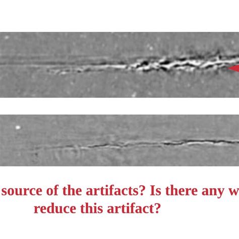 Wrinkle Artifacts In A Vertical Srct Slice Parallel To The Rotation