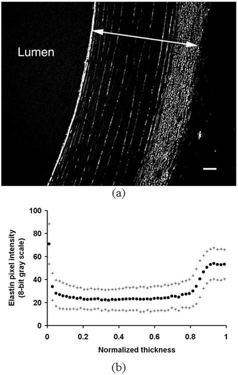 A A Representative Image Of Elastin Structure Taken From Arteries Download Scientific Diagram