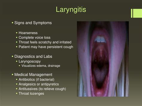 Ppt Disorders Of The Upper Airway Powerpoint Presentation Free