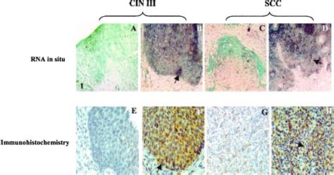 Representative Photomicrographs Show Expression Of Dsl Ligands In Cin