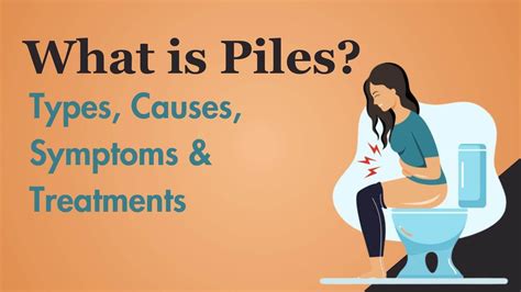 What Is A Pile Anus At Frank Jimenez Blog