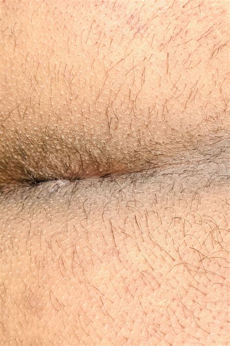 Close Up Asshole Pics Xhamster