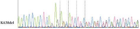 Figure3sequencing Electropherogram Of The Control Upper And Ii 3