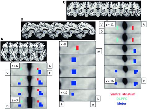 Limbic Associative And Motor Connectivity Dissociating Anterior And Download Scientific Diagram