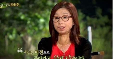 전신화상 이지선 13년전으로 돌아가기 싫다 이유는