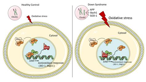 The Bach1nrf2 Axis In Brain In Down Syndrome And Transition To