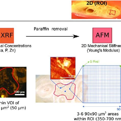 Chemical Structure Depiction Of Zoledronate From National Center For Download Scientific