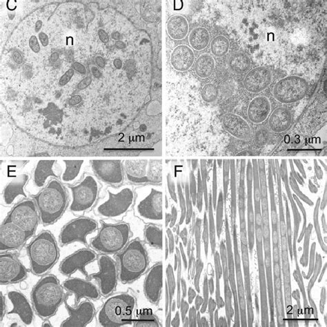Transmission Electron Microscopy Of Nuclear Localization Of The