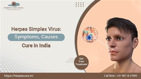 What Can Trigger An Outbreak Of The Herpes Simplex Virus At Alan