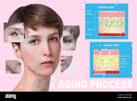 The Younger Skin And Aging Skin Elastin And Collagen A Diagram Of