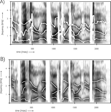 A Comparison Of Estimation Of Formant Patterns By Linear Prediction And