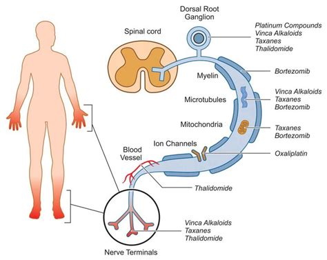 Chemotherapy Induced Peripheral Neuropathy Creative Bioarray Cellassay
