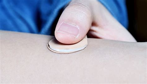 Microneedle Patch Could Offer Long Term Birth Control Futurity
