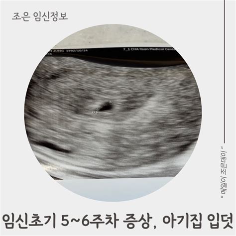 임신초기증상 5주차 6주차 아기집 태낭 난황 입덧시작시기 네이버 블로그