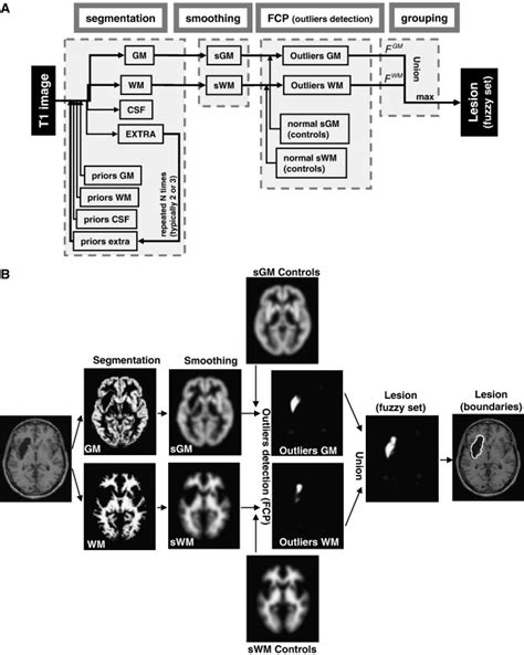 A A Schematic View Of The Different Steps From Segmentation To Download Scientific Diagram