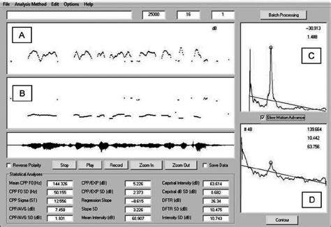 Application Of Spectral Cepstral Analysis Methods To Continuous Speech Download Scientific