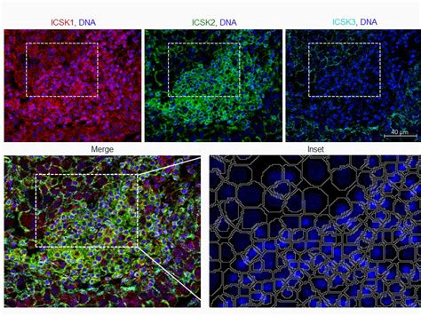 Standard Biotools On Linkedin Imagingmasscytometry Highpleximaging Cellsegmentation Antibodies