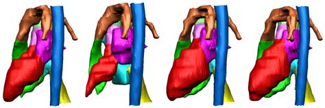 heart model extracted from time varying segmented volume illustrating