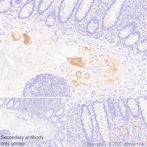 Anti Complement Factor B Antibody Epr27443 6 Ab309149 Abcam