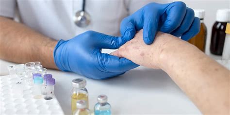 How To Test For Herpes Essential Tips For Reliable Screening