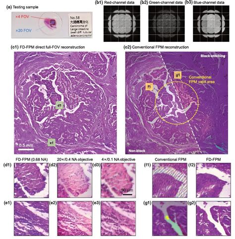Feature Domain Fourier Ptychographic Microscopy Promotes Pathological