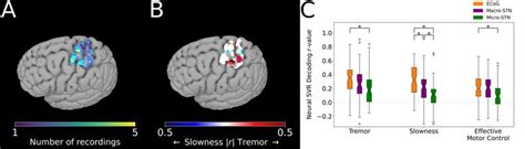 cortical tremor and slowness decoding models were distributed