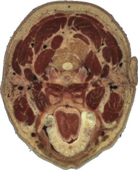 Cross Section At Level Of C1 Diagram Quizlet
