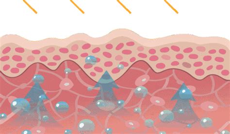 再传捷报安龄生物新二类医疗器械获NMPA批准开启皮肤再生新赛