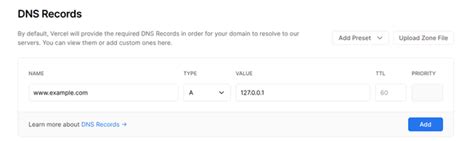 how to manage vercel dns records