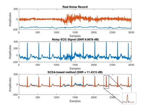 Enhancement For Ecg Signals From Top To Bottom A Real Noise Plot